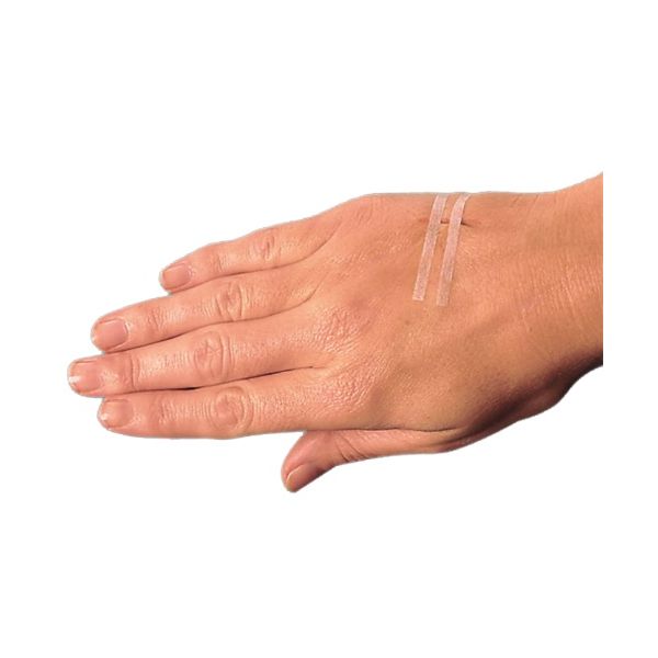 Steri Strips